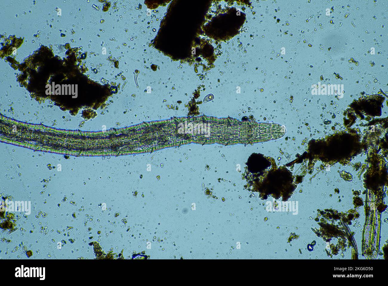 parasite humain. maladie intestinale d'infection intestinale. infection ...