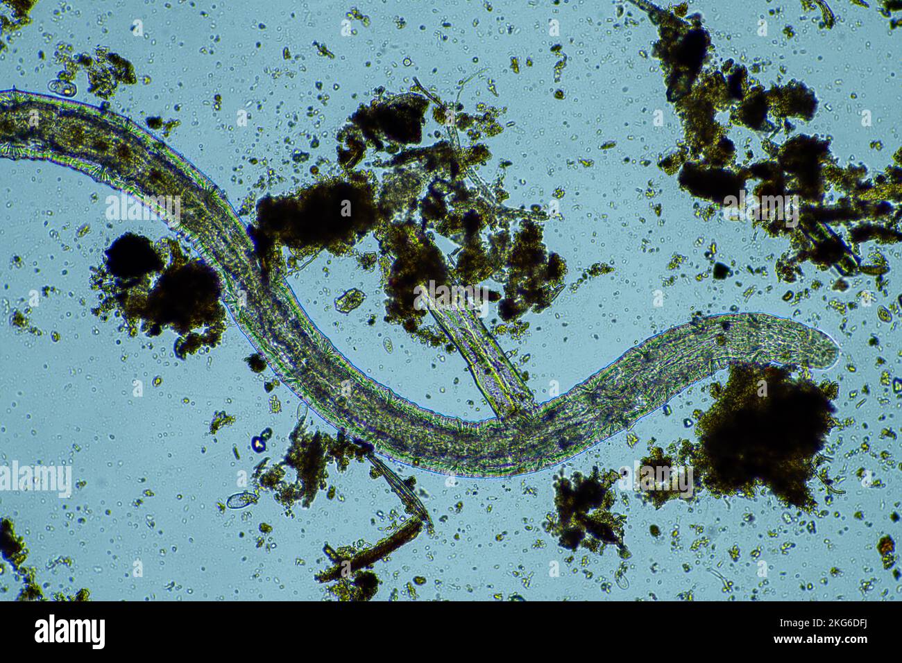 parasites humains dans la santé intestinale humaine Photo Stock - Alamy