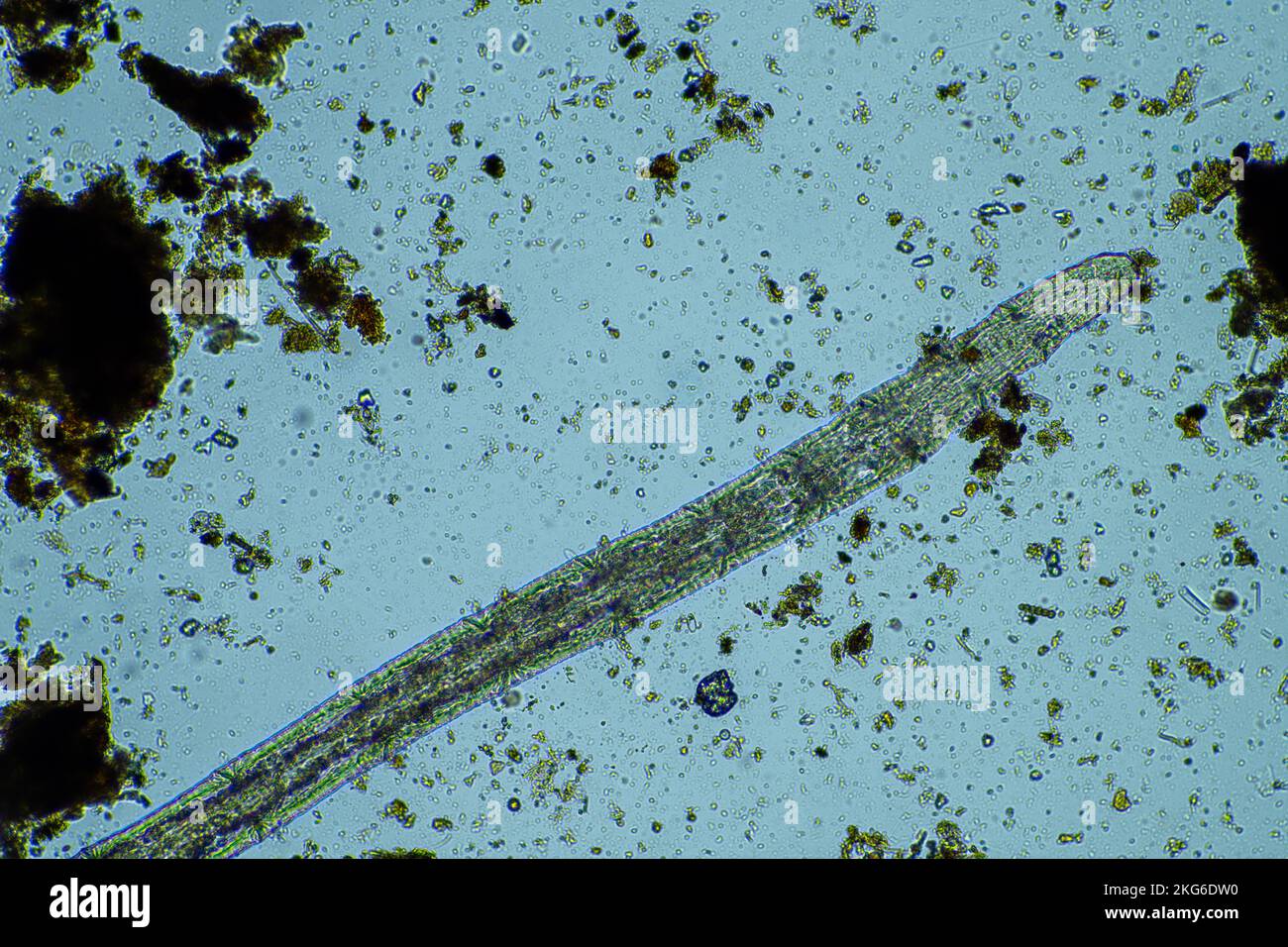 parasite humain. maladie intestinale d'infection intestinale. infection ...