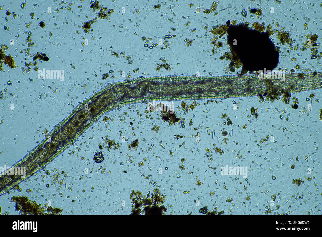 parasite humain. maladie intestinale d'infection intestinale. infection ...