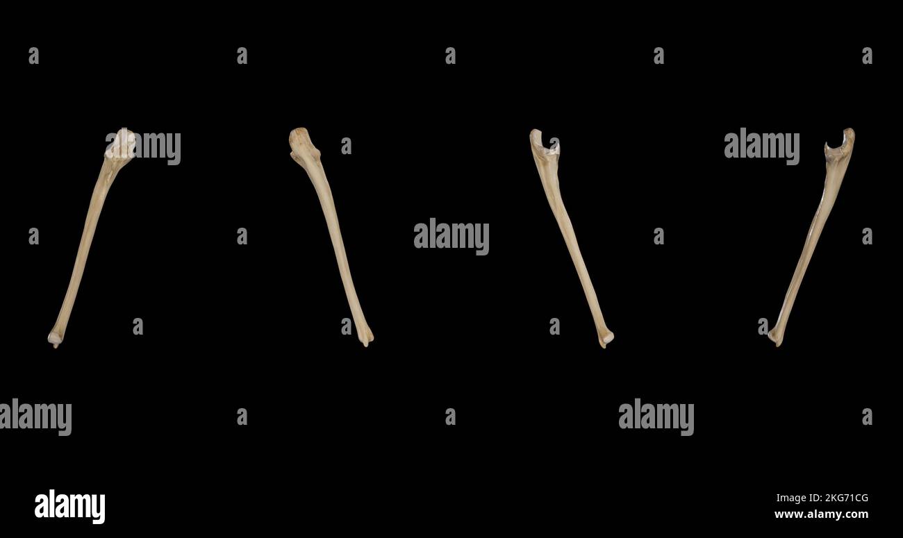 Articulation radioulnaire proximale Banque de photographies et d’images à haute résolution - Alamy