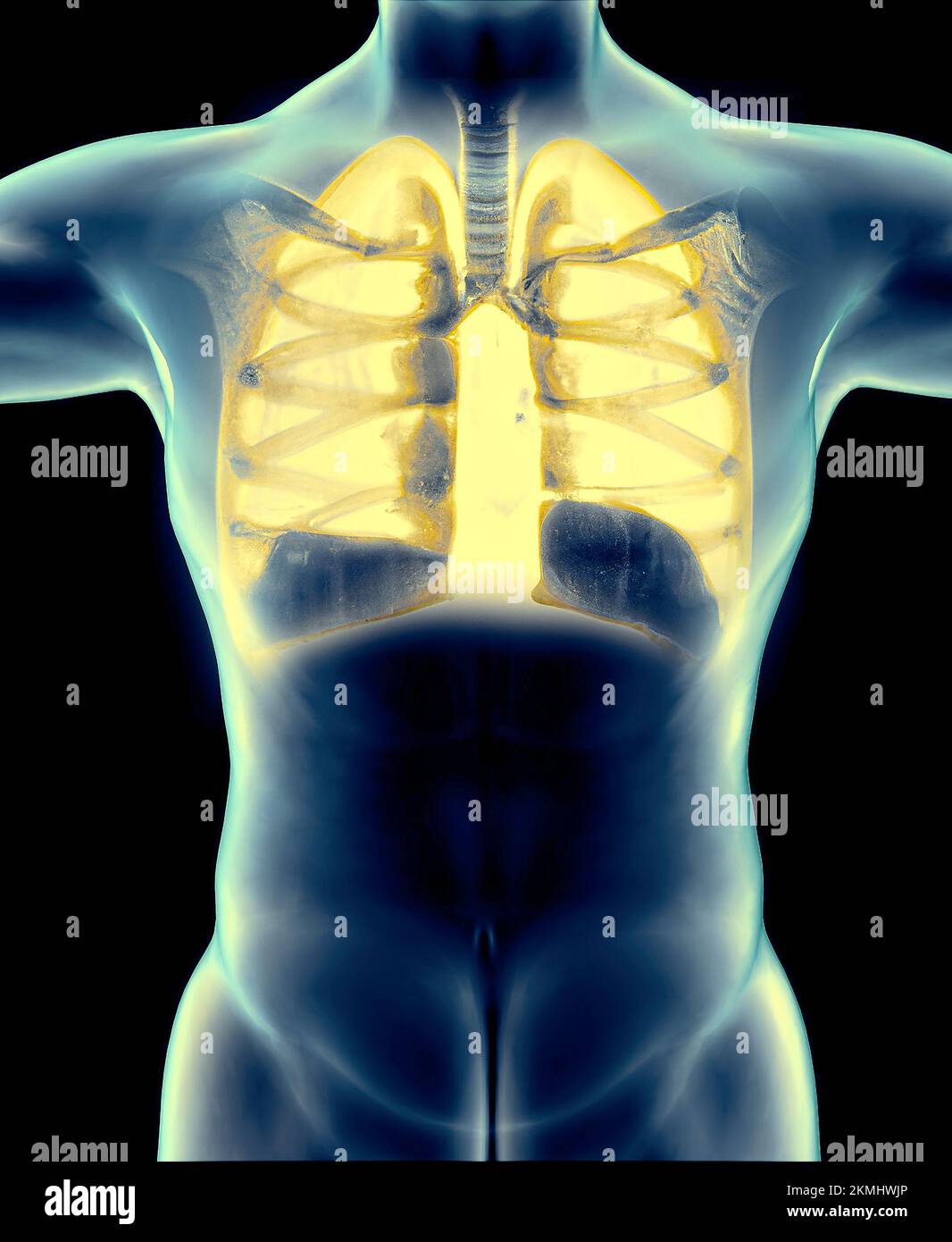 Anatomie humaine, problèmes avec le système respiratoire, poumons ...