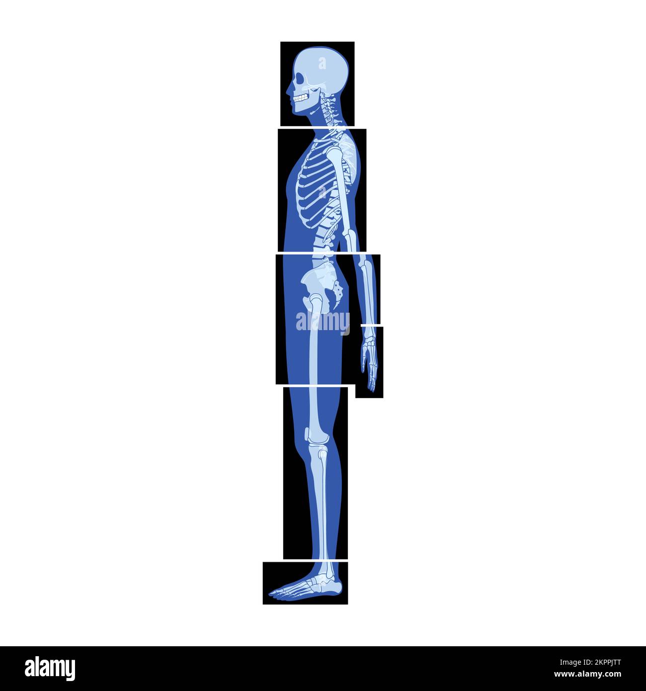 Ensemble de parties du corps humain du squelette à rayons X - mains ...