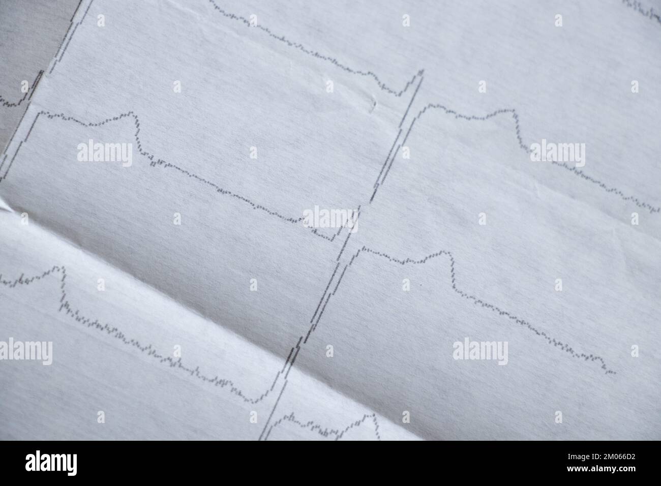 Diagramme de cardiogramme Banque de photographies et d’images à haute ...