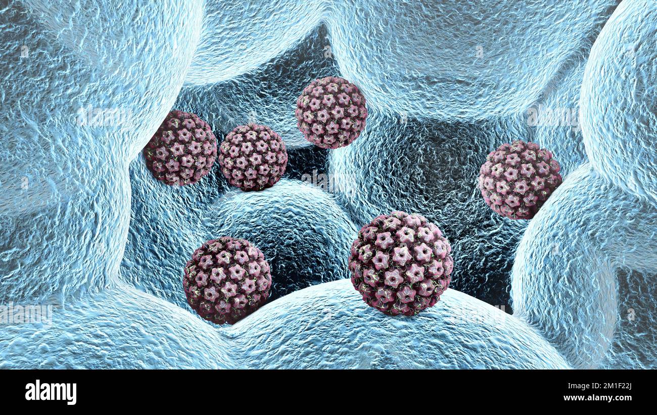 Infection à papillomavirus. Virus. Le VPH est l'infection transmissible ...