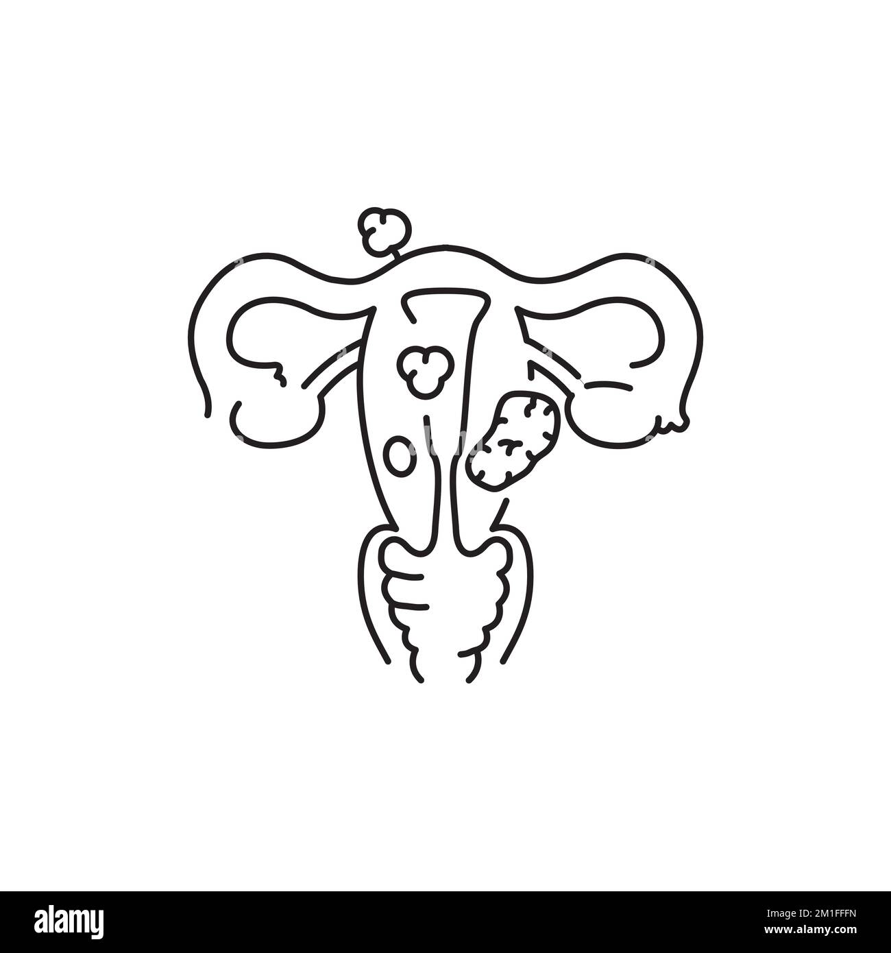 Icône de la ligne de couleur du myome utérin. Problème de gynécologie ...