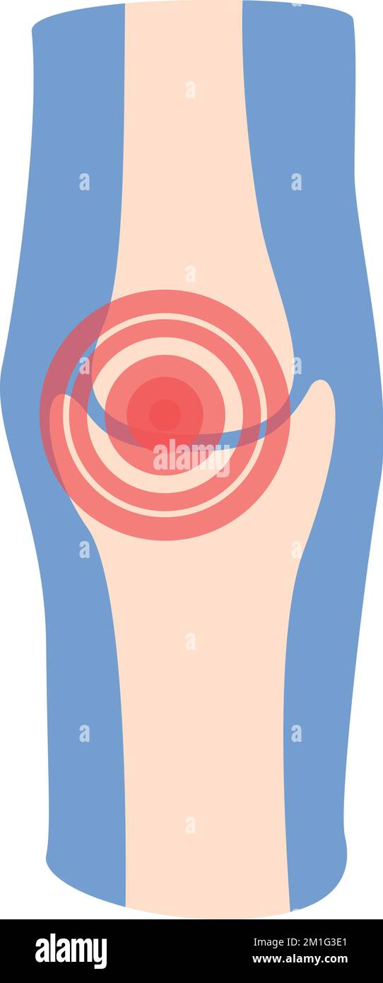 Anatomie du coude et cartilage Banque d'images vectorielles - Page 2 ...