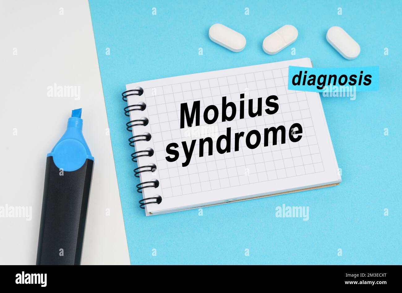 Syndrome de mobius Banque de photographies et d’images à haute ...