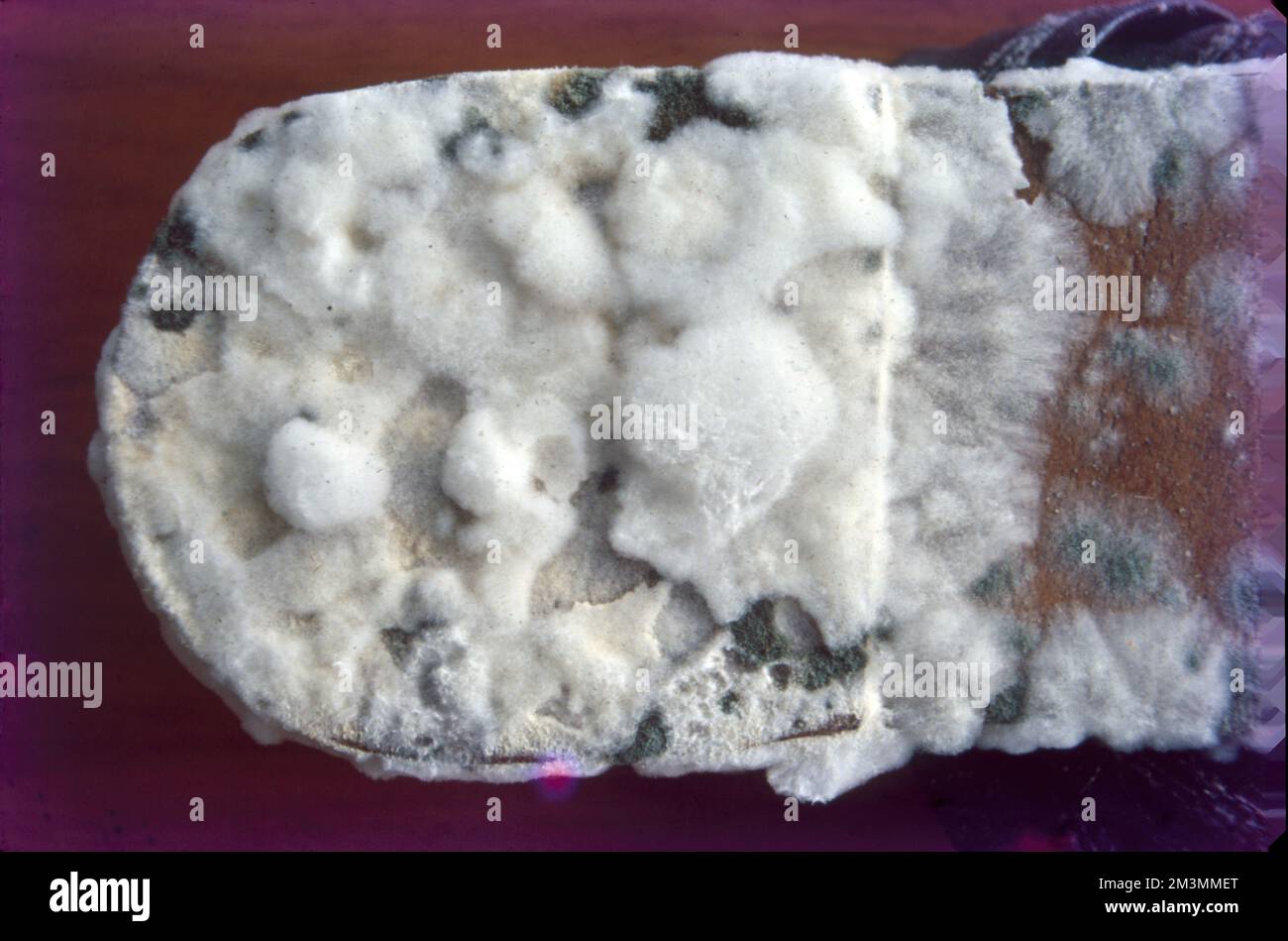 Dans des conditions environnementales favorables, les spores fongiques ...