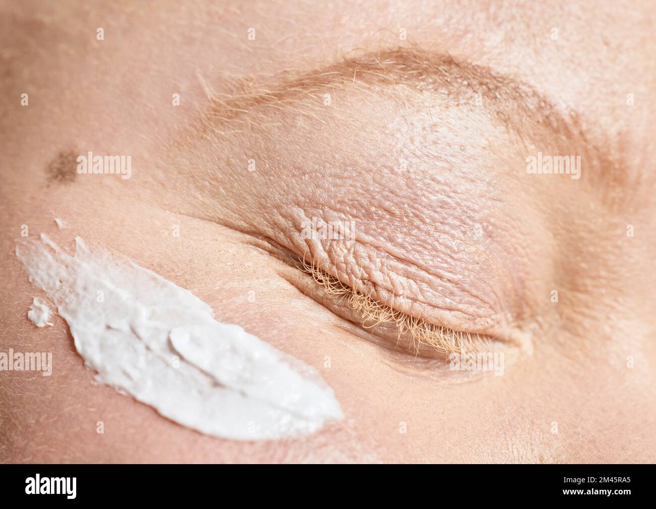 Soins de la peau, albinos et femme avec écran solaire de gros plan pour ...