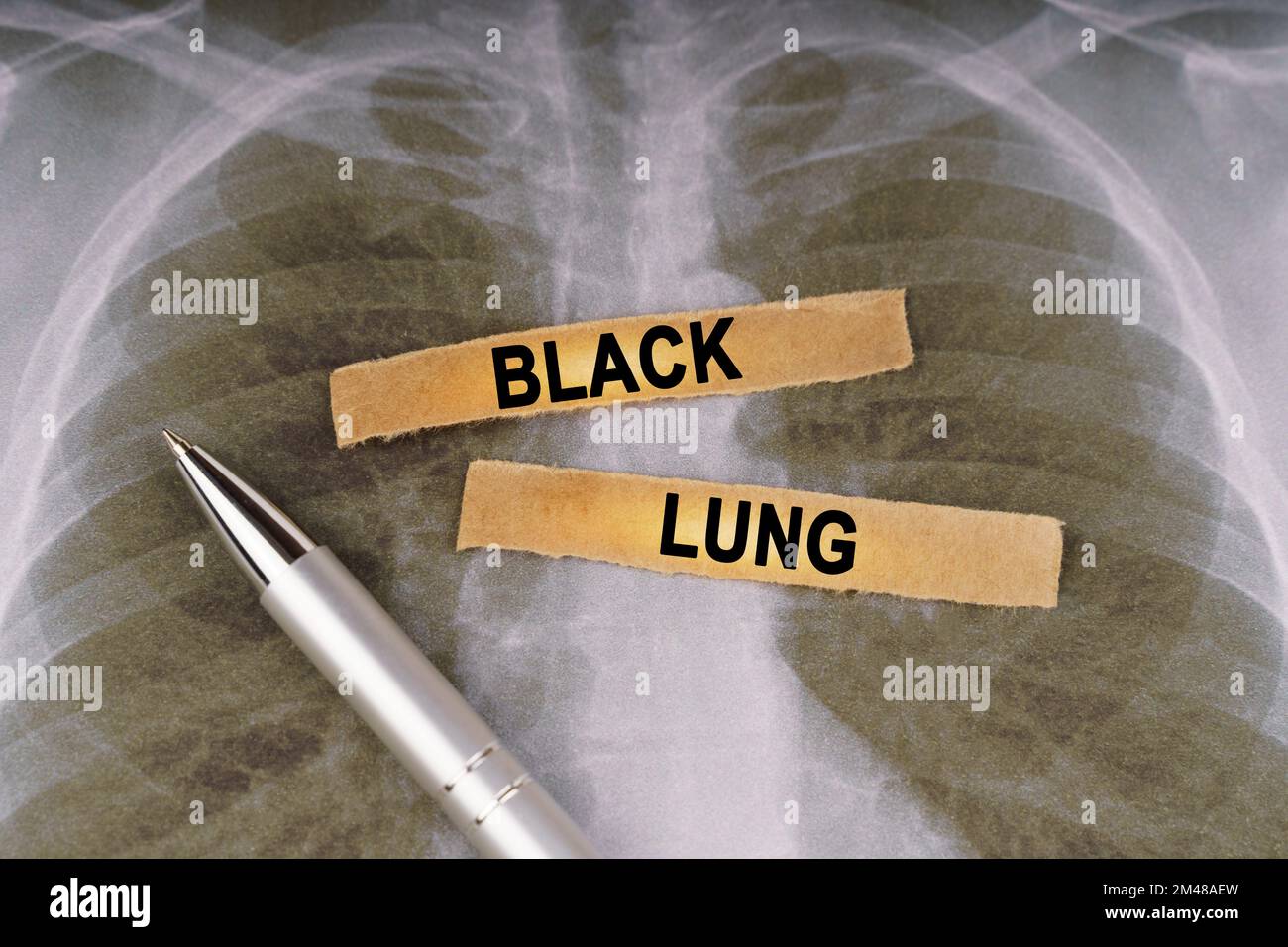 Concept médical. Sur une radiographie thoracique humaine, un stylo et ...