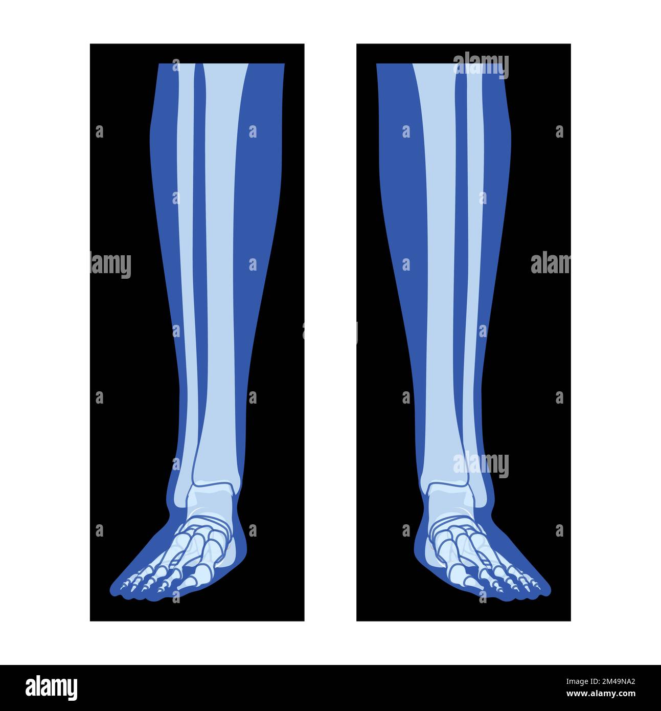 X-Ray pieds jambes Skeleton, Fibula, Tibia - phalanges corps humain, os ...