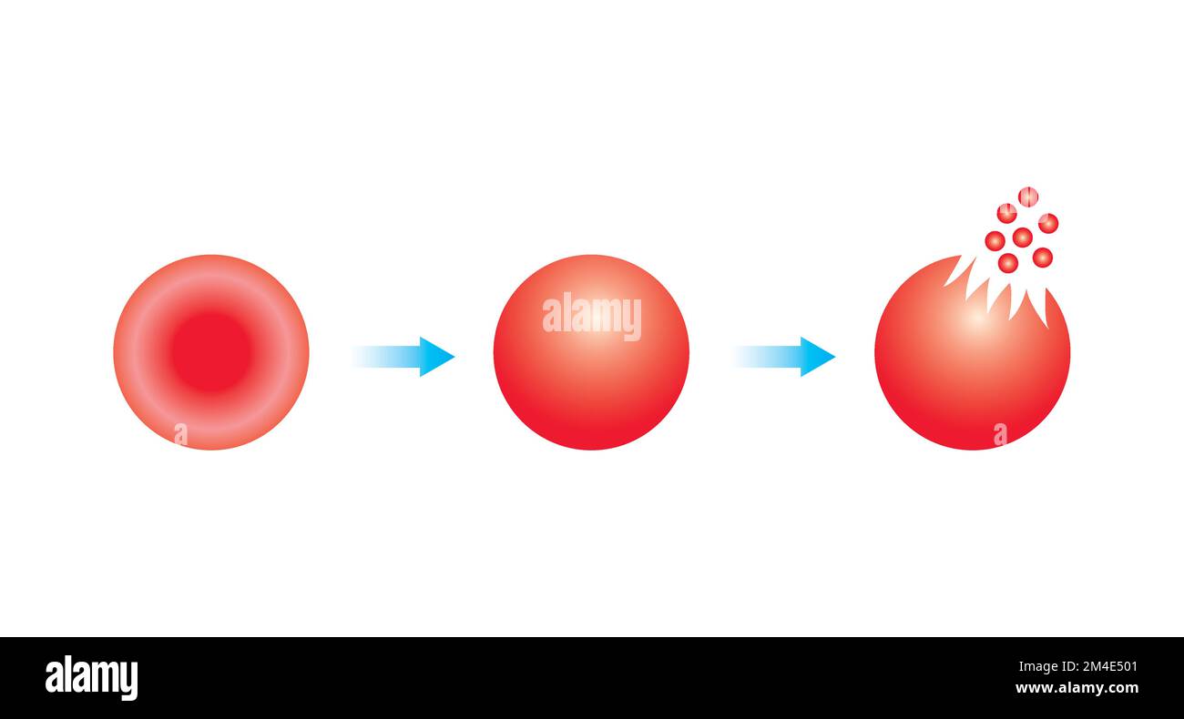 Conception scientifique de l'hémolyse. La destruction des globules ...
