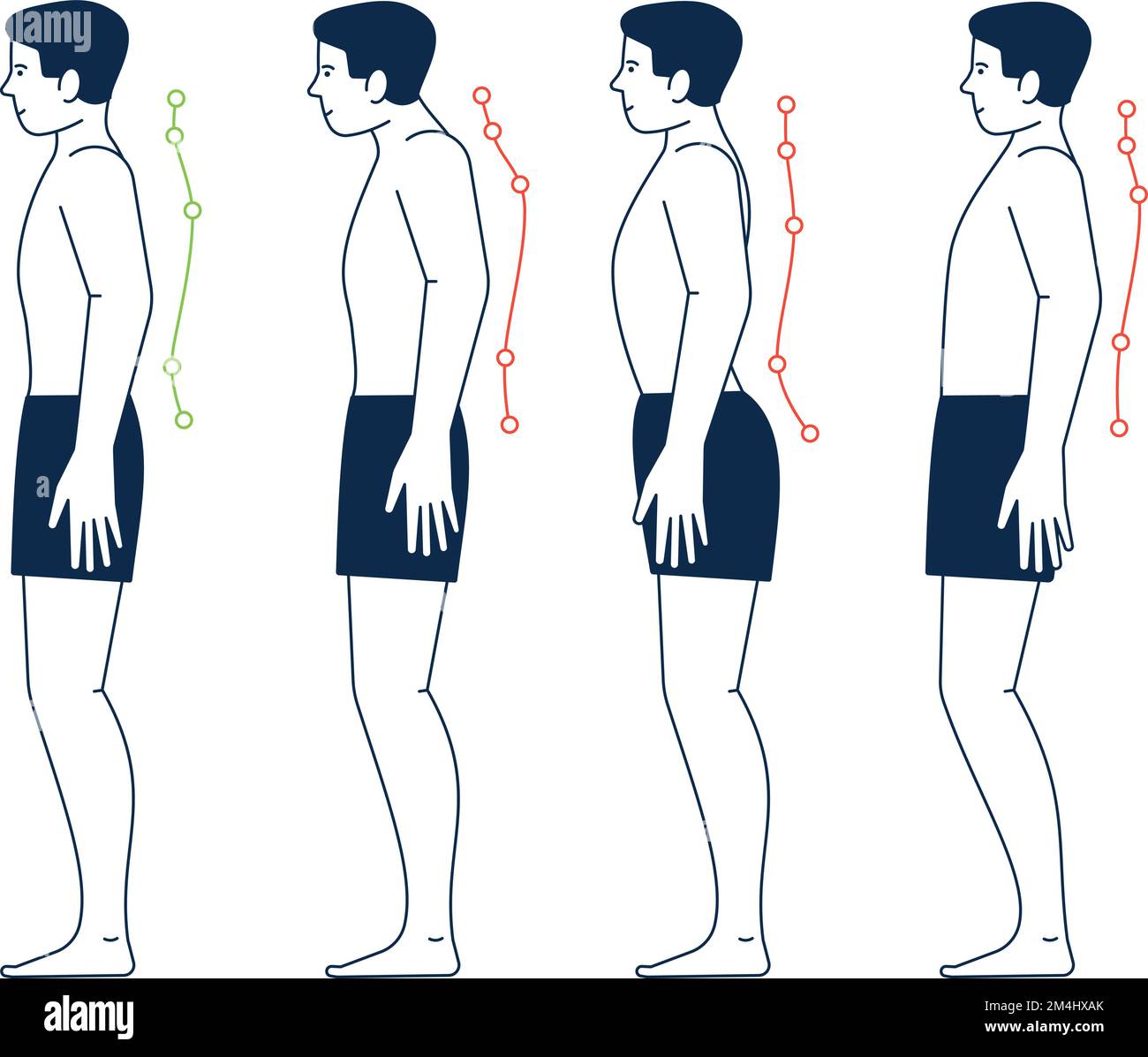 Corps masculin avec postures de colonne vertébrale droite et incorrecte ...