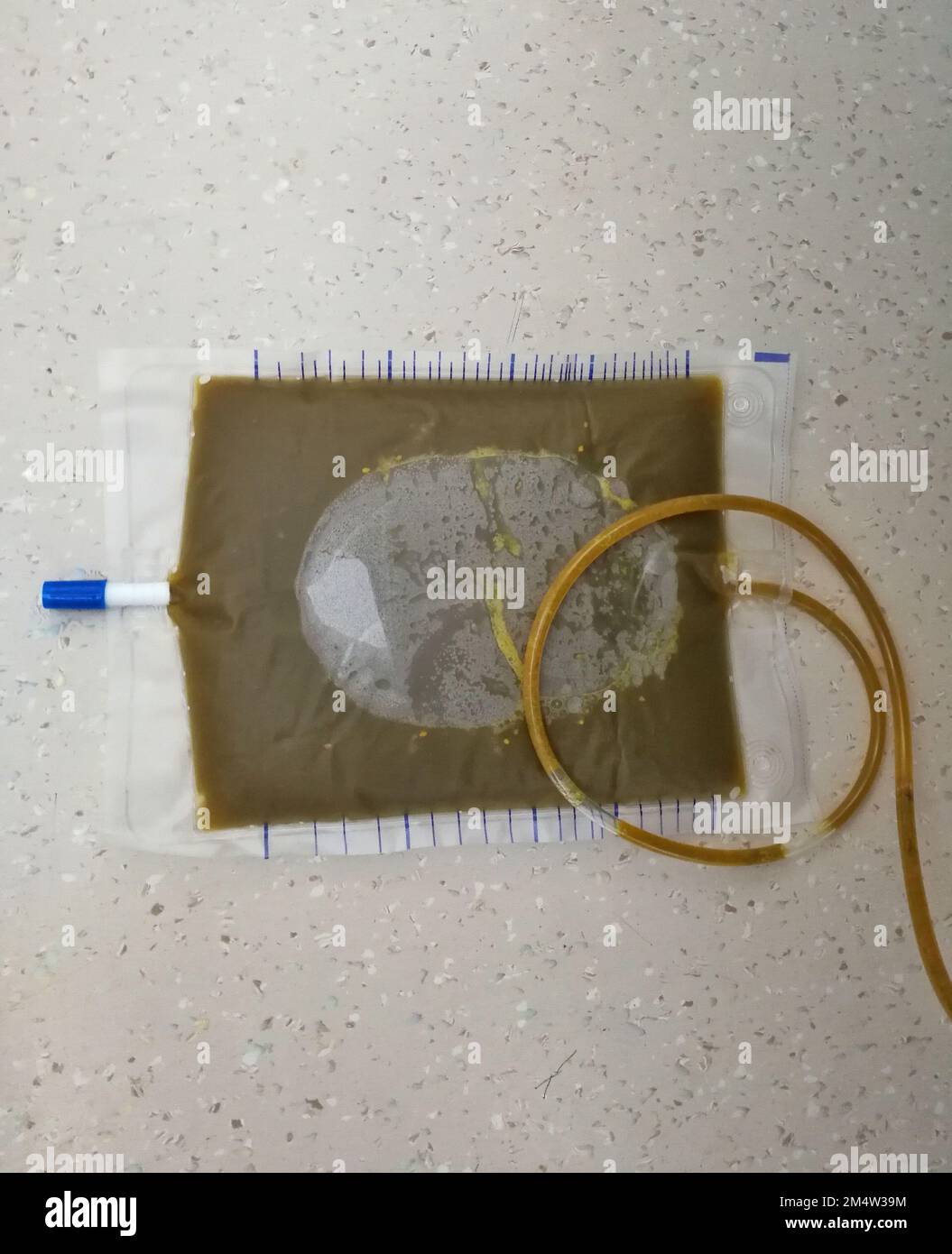 Fluide biliaire Banque de photographies et d’images à haute résolution ...