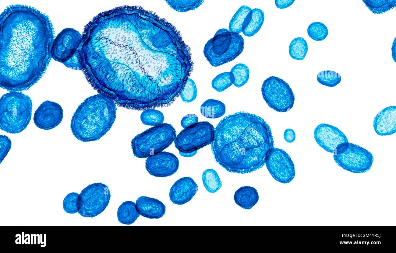 Varicelle, ou monkeypox, particules de virus, illustration. La ...
