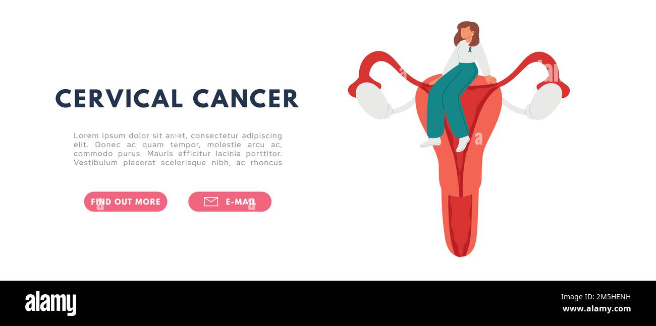 Concept de cancer du col de l'utérus. Symptôme de la maladie ...