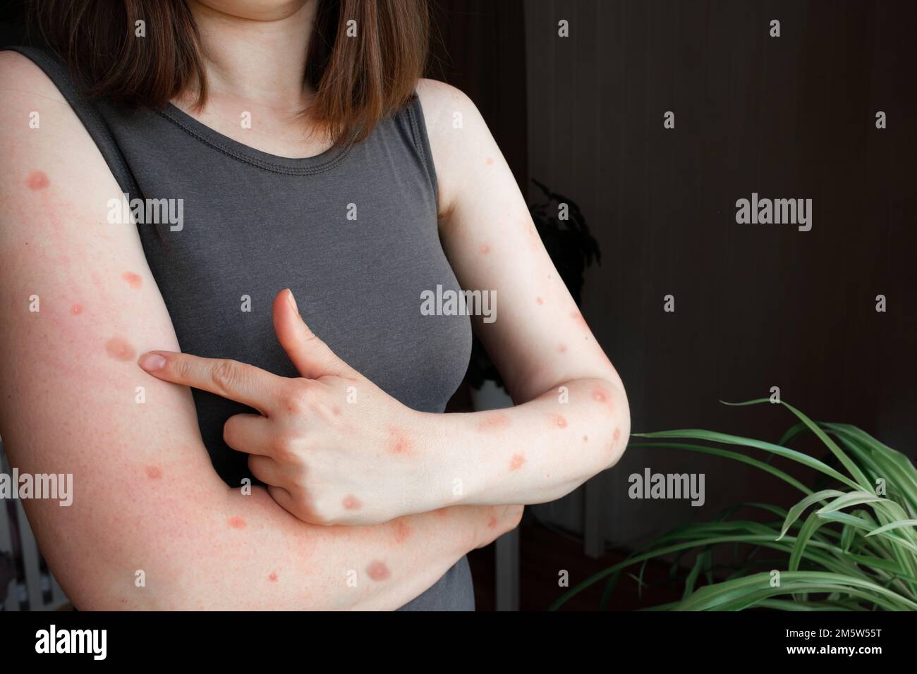 La nouvelle maladie de Monkeypox est dangereuse dans le monde entier ...