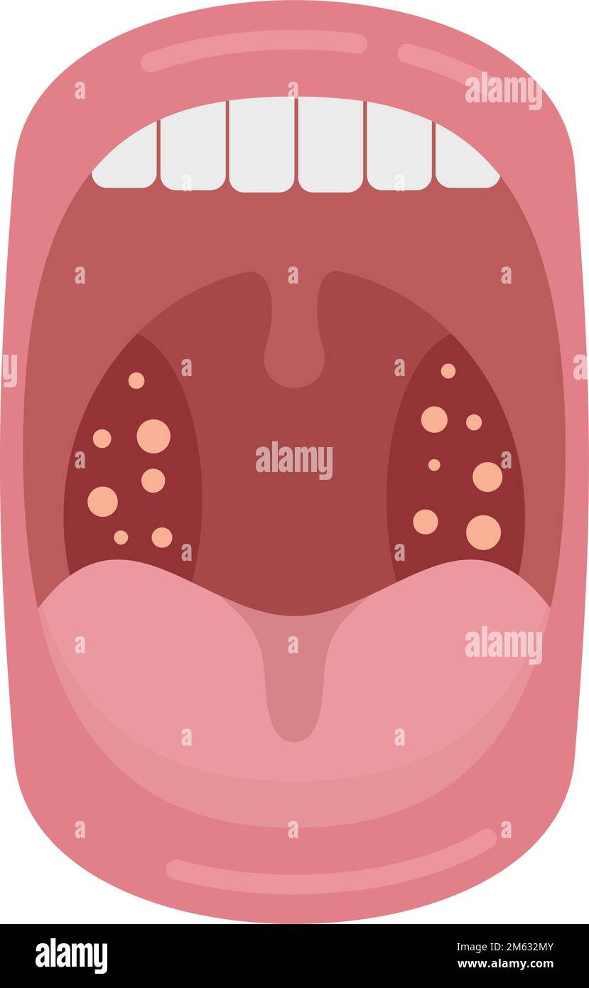 Icône de la maladie de la bouche vecteur plat. Anatomie bactérienne ...