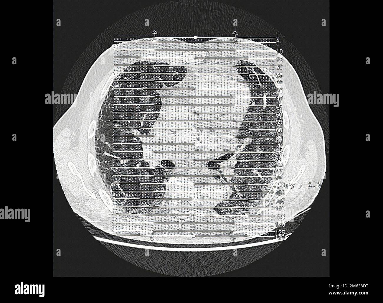Imagerie médicale Banque de photographies et d’images à haute ...