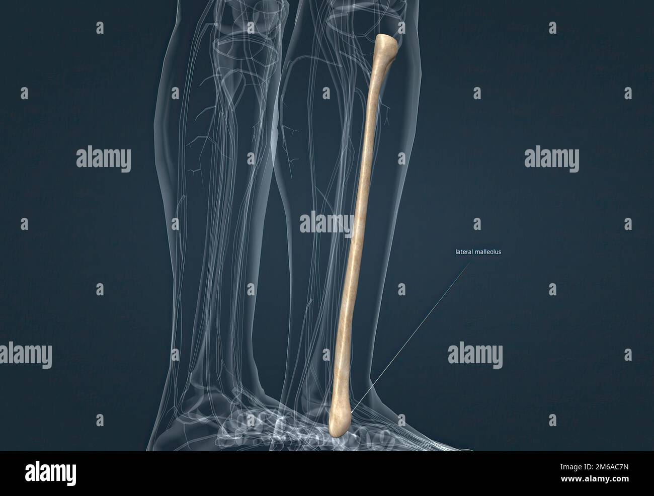 Le péroné ou l'os du mollet est l'os situé sur le côté latéral du tibia ...