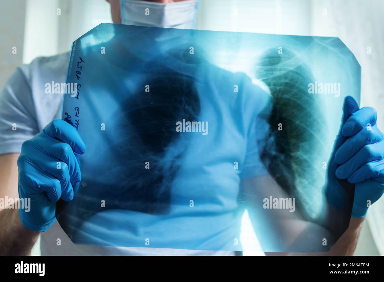 Film radiographique du thorax Banque de photographies et d’images à ...