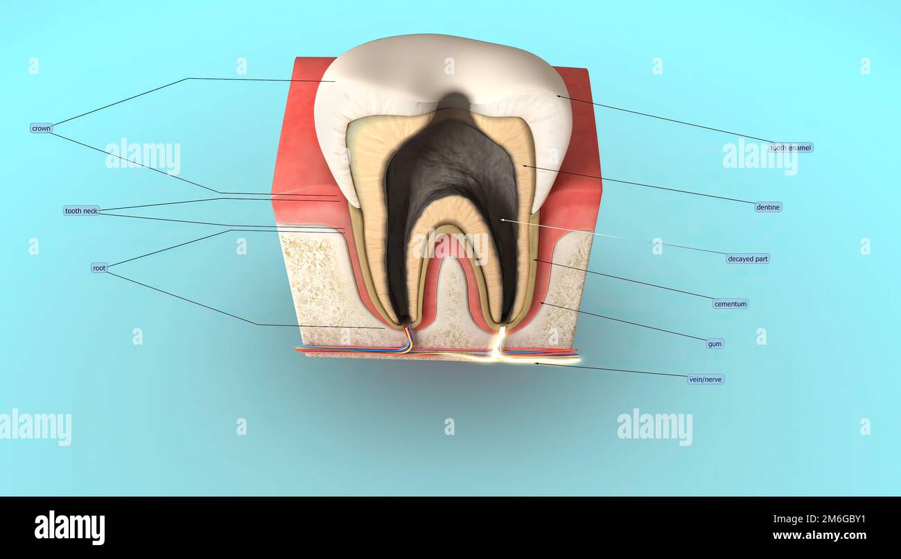 Anatomie de la dent et des gencives et structures de support entourant ...