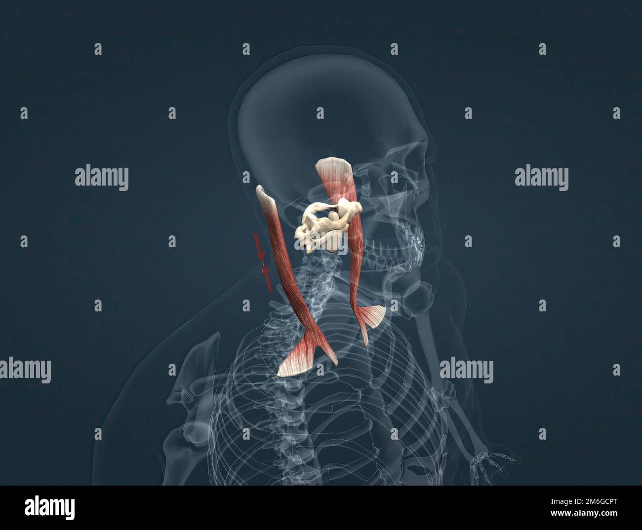 Le sternocleidomastoïde est le muscle le plus superficiel et le plus ...