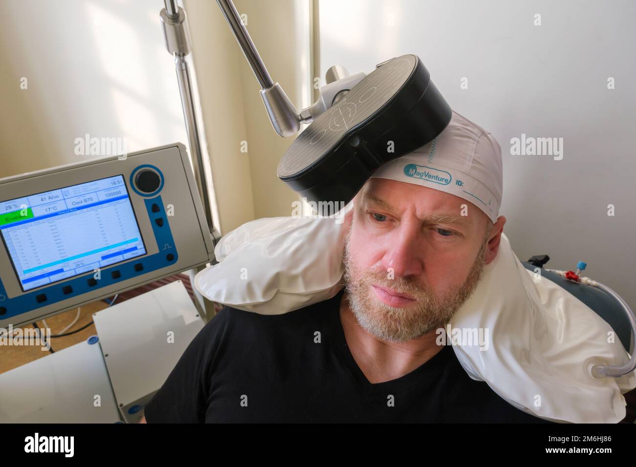 Montréal, CA - 15 novembre 2022 : patient subissant une stimulation ...