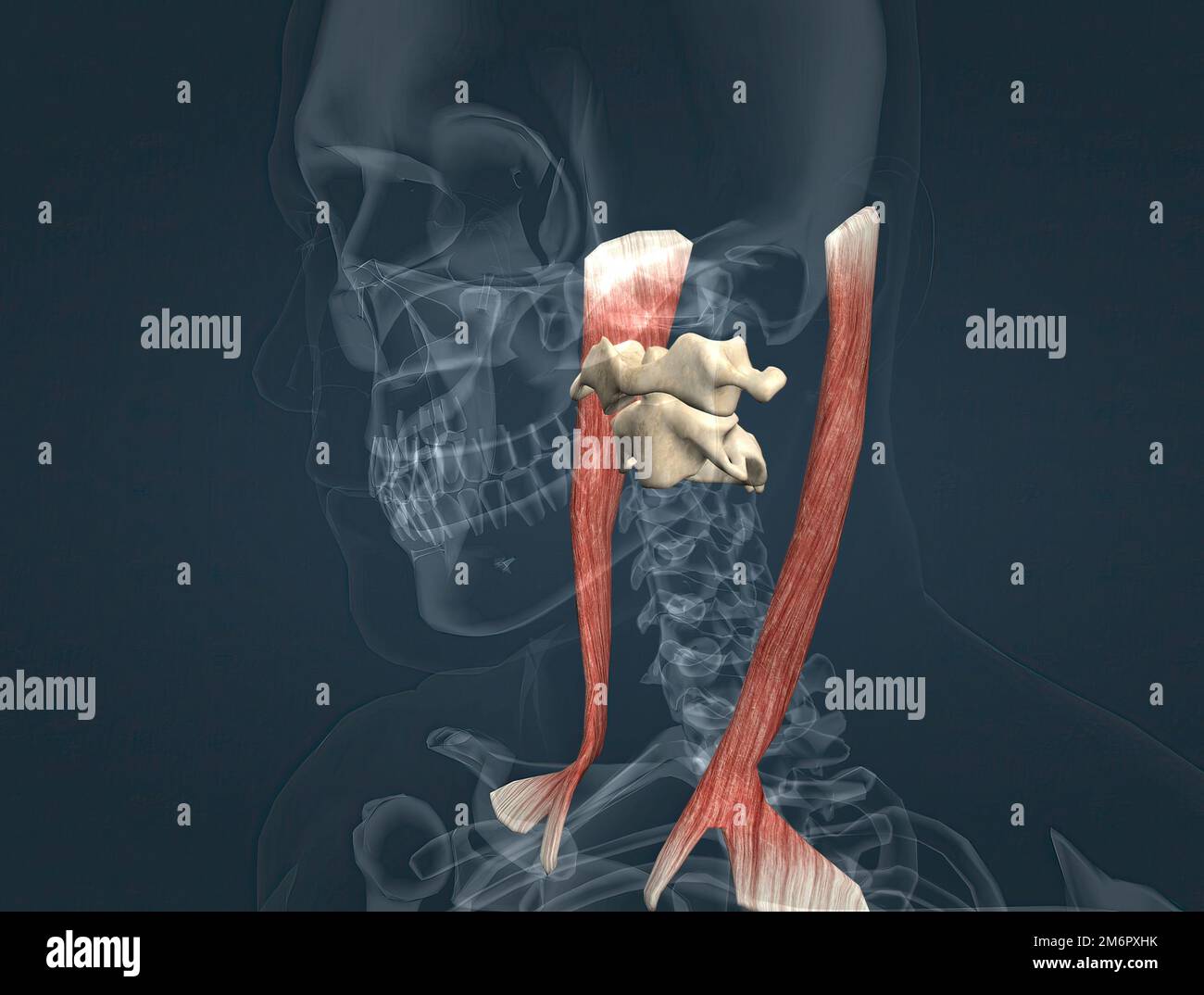 Le sternocleidomastoïde est le muscle le plus superficiel et le plus ...