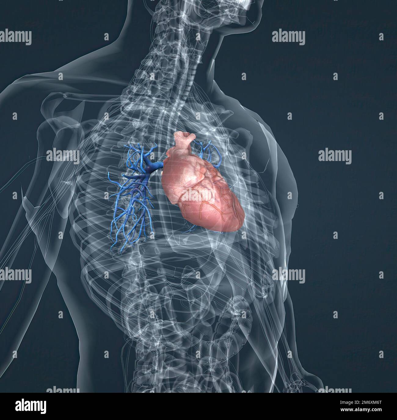 Les vaisseaux sanguins de la circulation pulmonaire sont les artères ...
