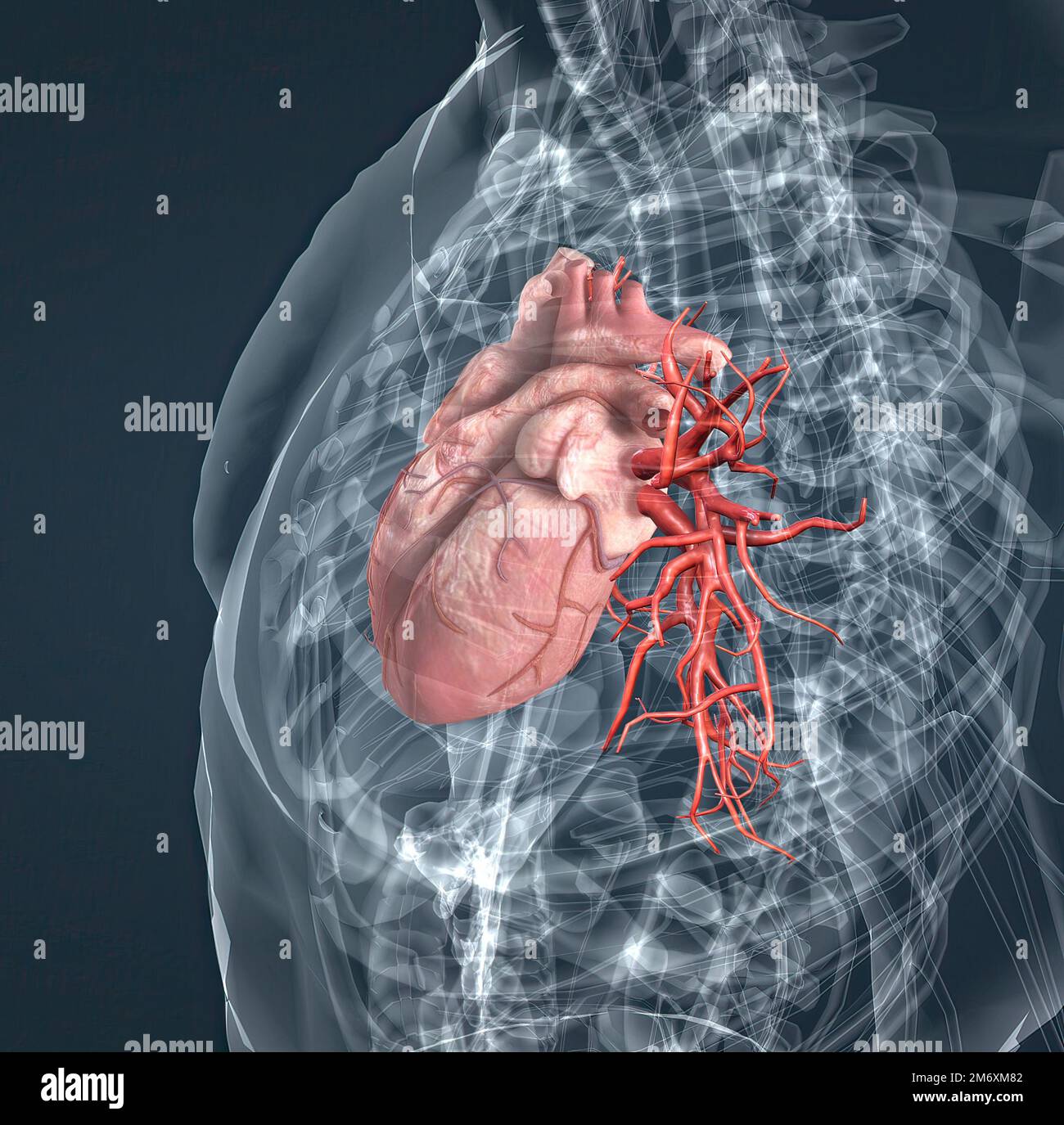 Les vaisseaux sanguins de la circulation pulmonaire sont les artères ...