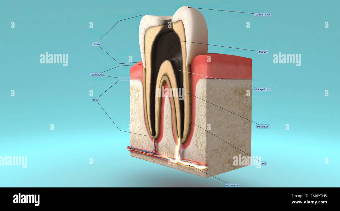 Anatomie de la dent et des gencives et structures de support entourant ...