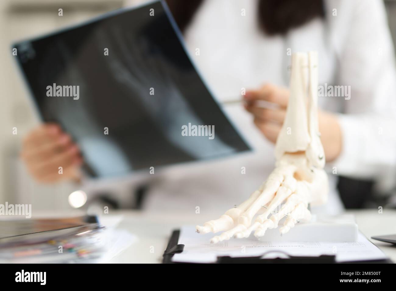 Cancer du pied Banque de photographies et d’images à haute résolution ...