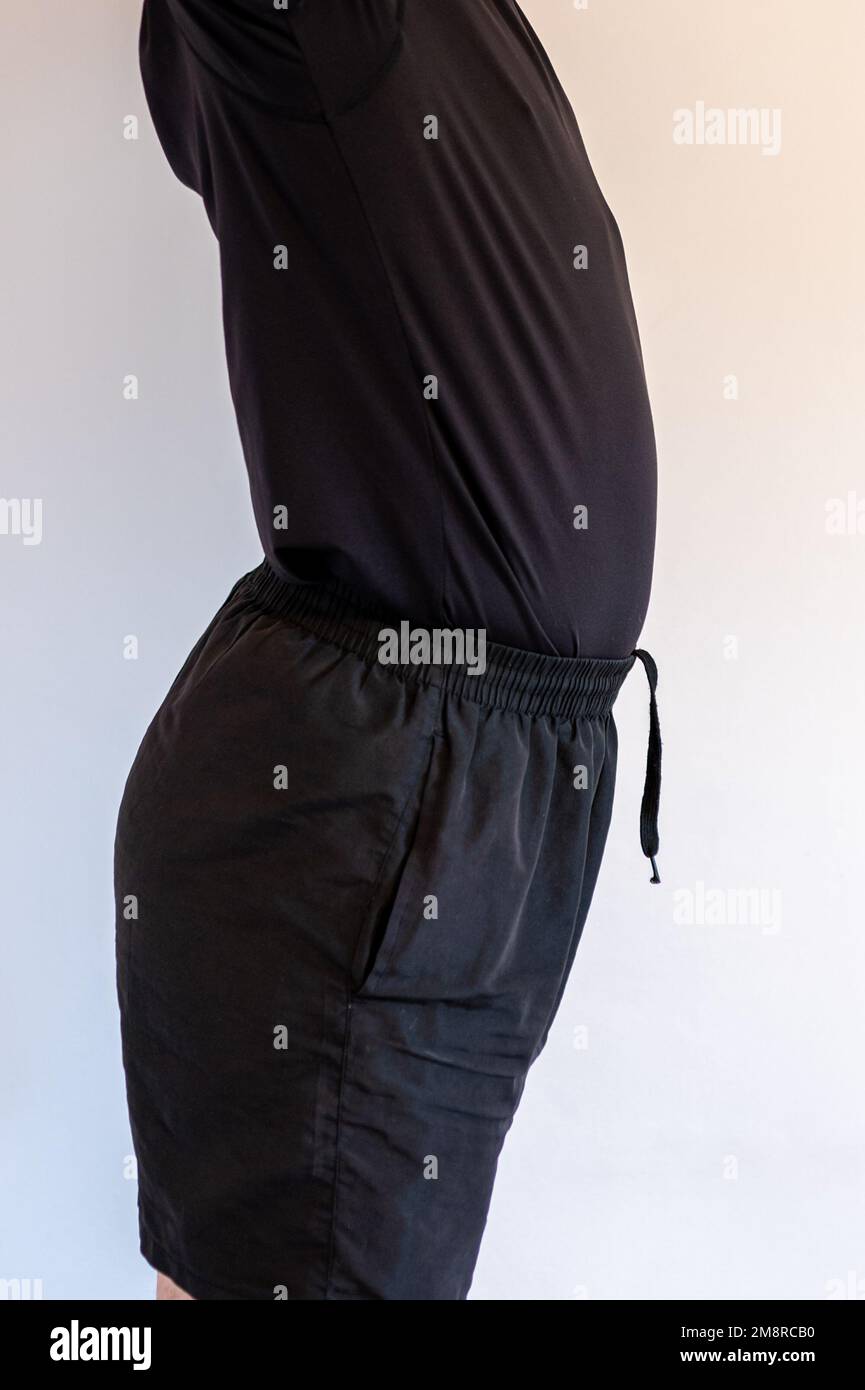 Courbure de la lordose de la colonne vertébrale. Homme avec lordose. Un ...