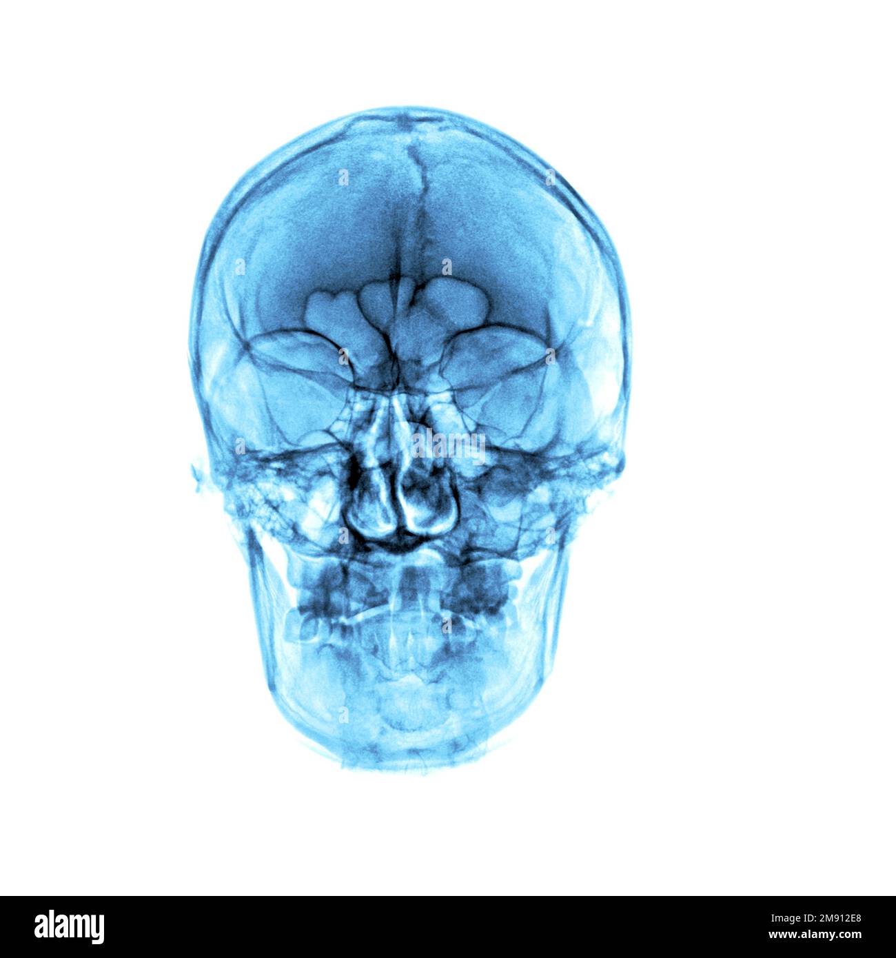 Anatomie normale du corps humain Banque de photographies et d’images à ...