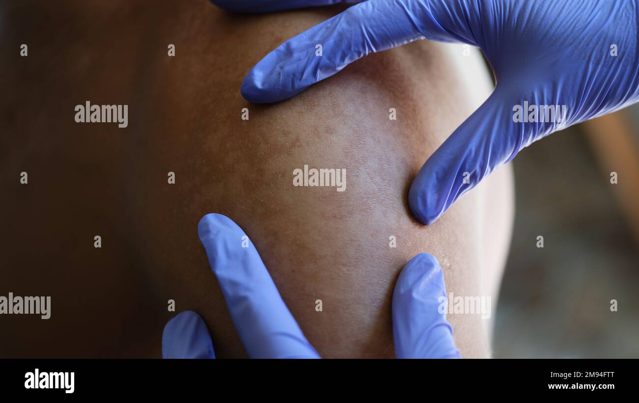 Pigmentation de la peau Banque de photographies et d’images à haute ...