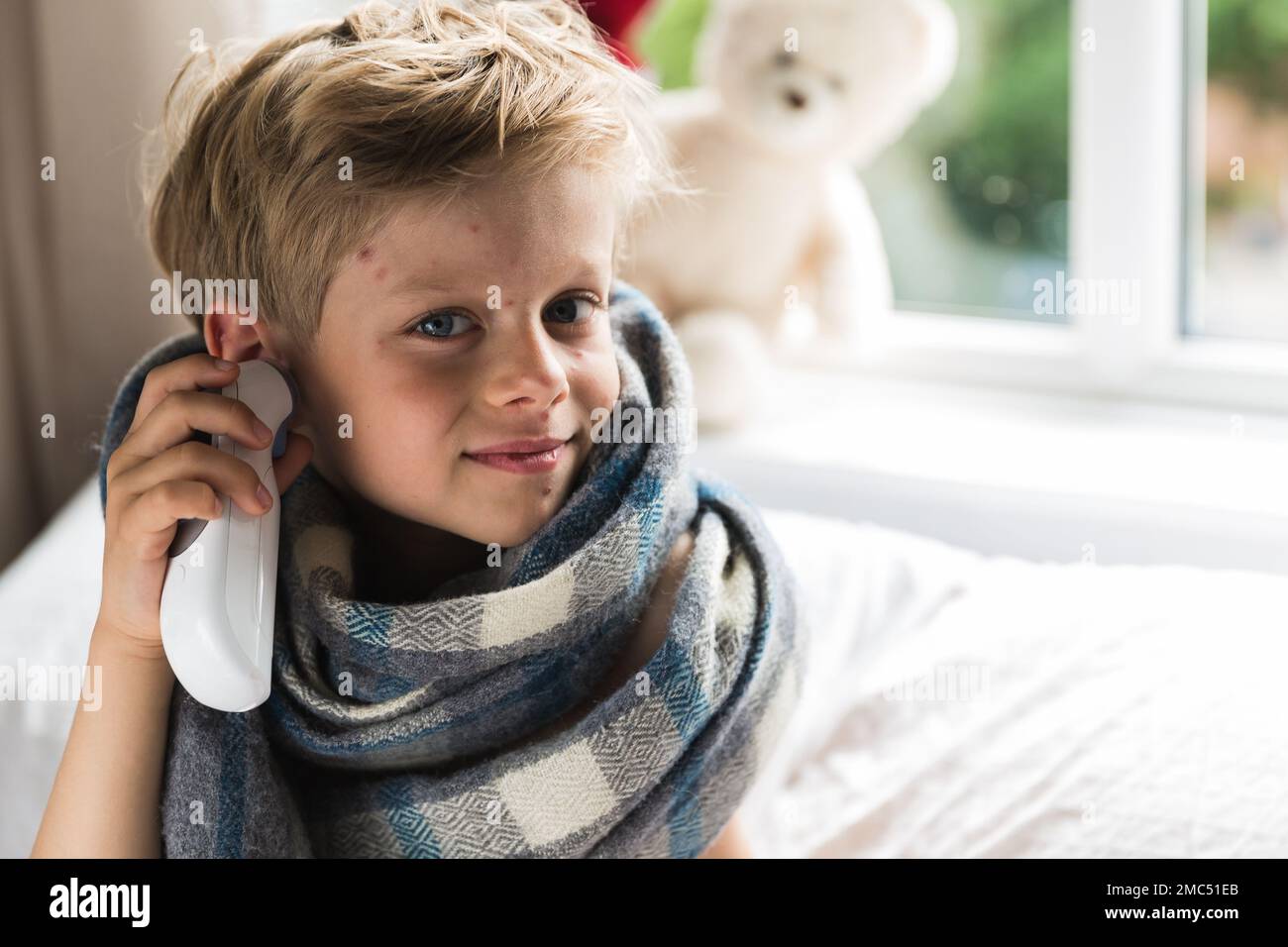 Jeune enfant avec la varicelle. Enfant malade avec la varicelle. Virus ...