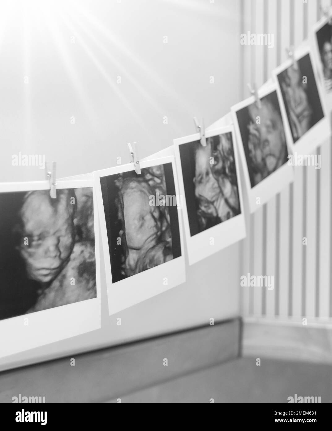 Collage de photos en noir et blanc Histoire d'images échographiques de ...