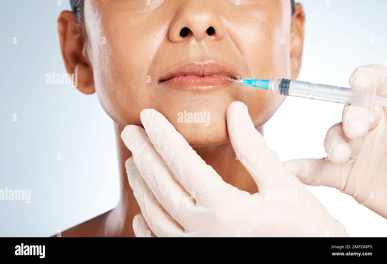 Injection, chirurgie plastique et remplissage de lèvre sur le visage de ...