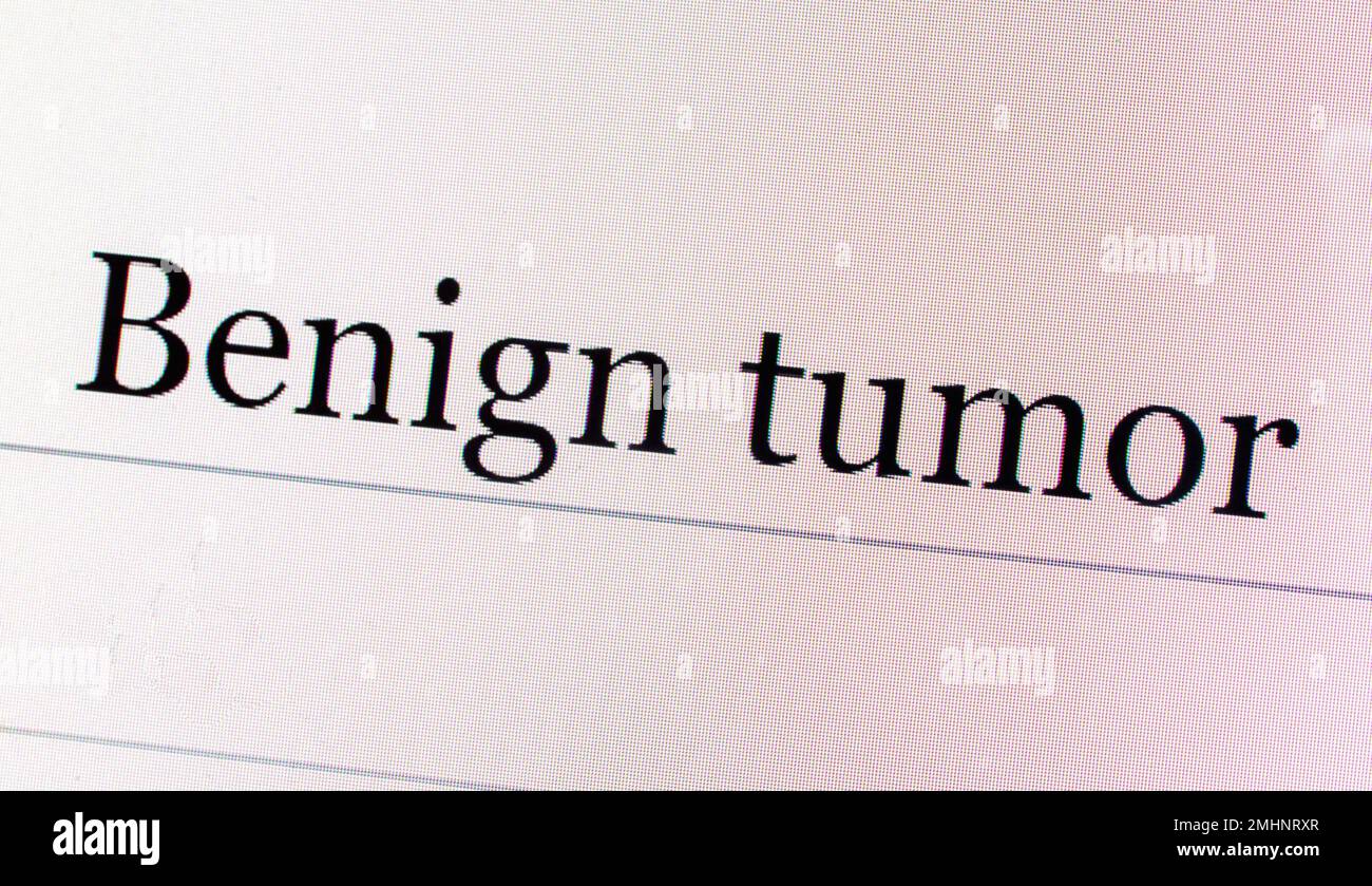 Benign tumor Banque de photographies et d’images à haute résolution - Alamy