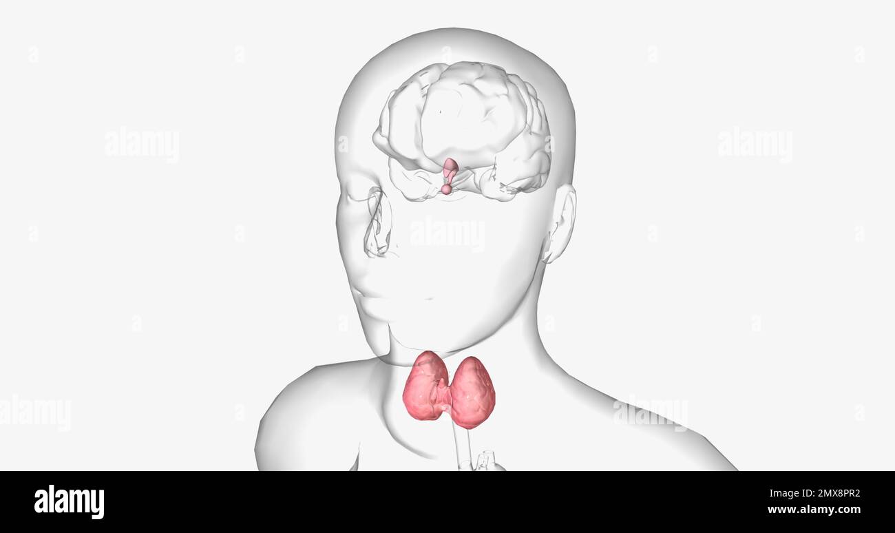 Hashimoto thyroiditis Banque de photographies et d’images à haute ...