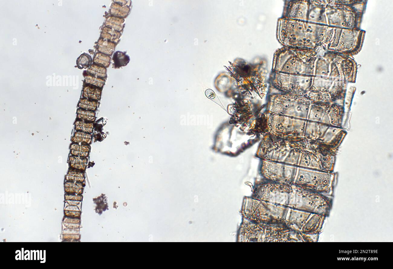 Zooplankton microscope Banque de photographies et d’images à haute ...