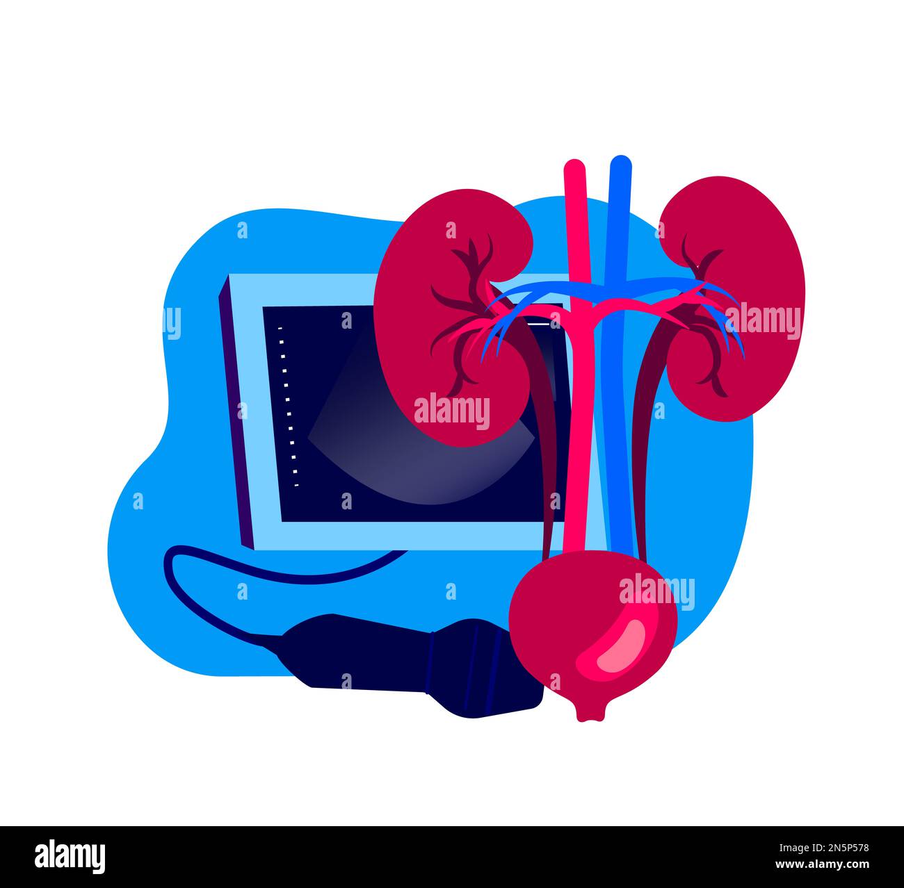 Néphrologie échographie Sonographie, examiner diagnostic, consultation ...