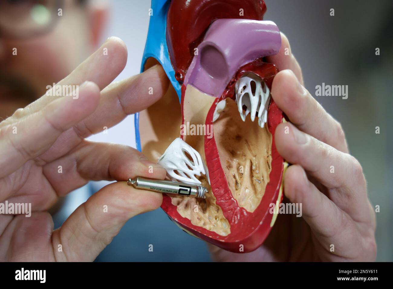 Le Dr Derek Exner, cardiologue et spécialiste du rythme cardiaque chez ...