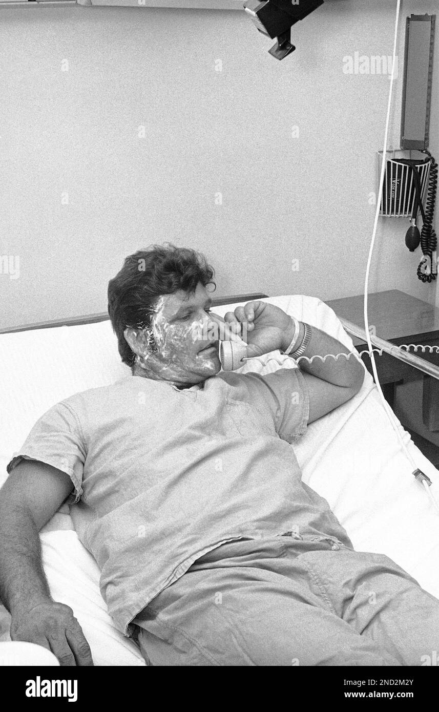 Lodger A. Dauphine, a burn victim from the Texas City Refinery ...