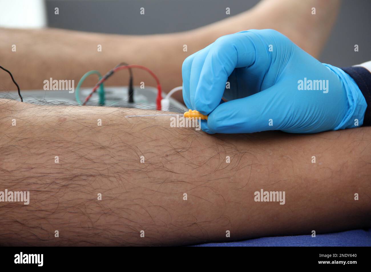 Électromyographie dans les membres inférieurs, technique d ...