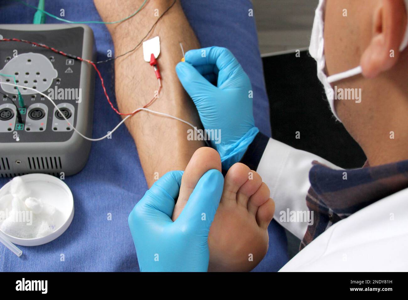 Électromyographie dans les membres inférieurs, technique d ...