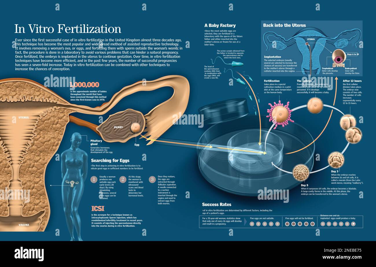 Infographie du processus de fécondation in vitro, de ce qu'il est et de ...
