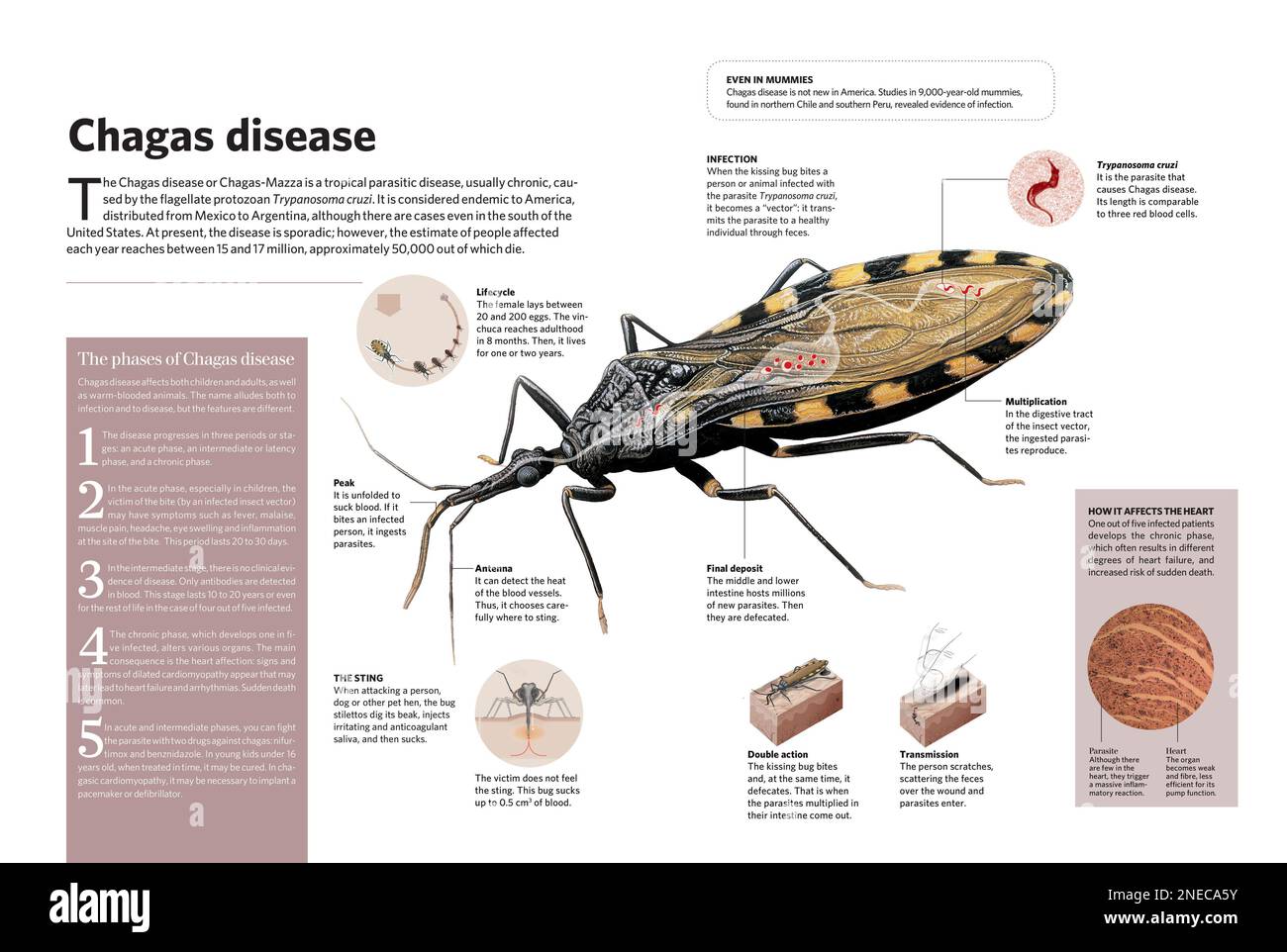Infographie sur la maladie de Chagas, une maladie parasitaire tropicale ...